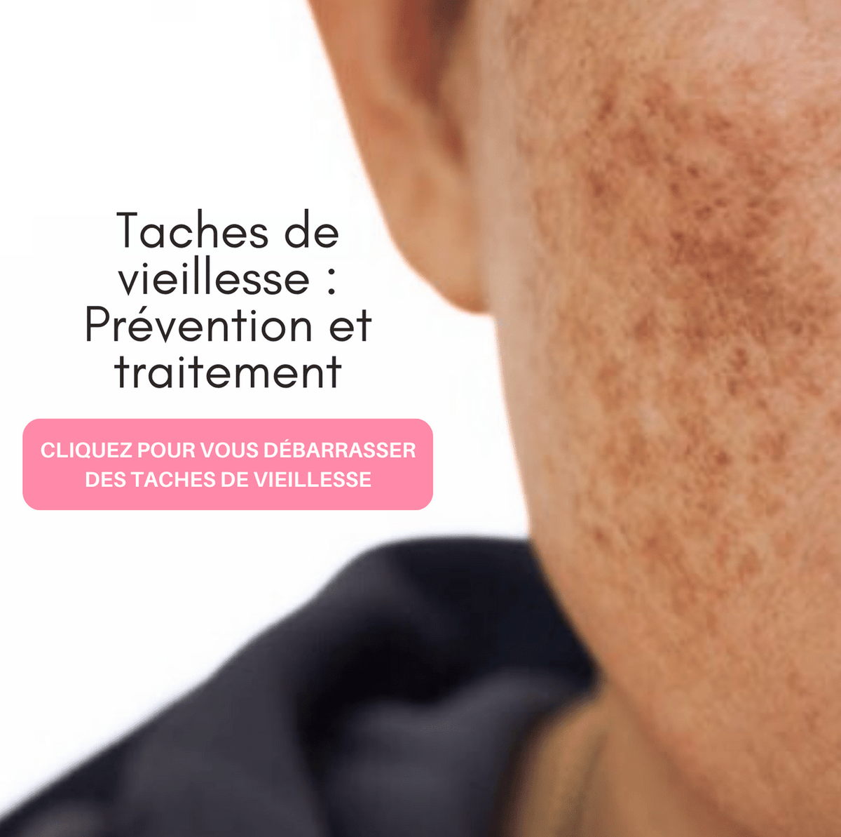 Taches de vieillesse : Traitement et prévention