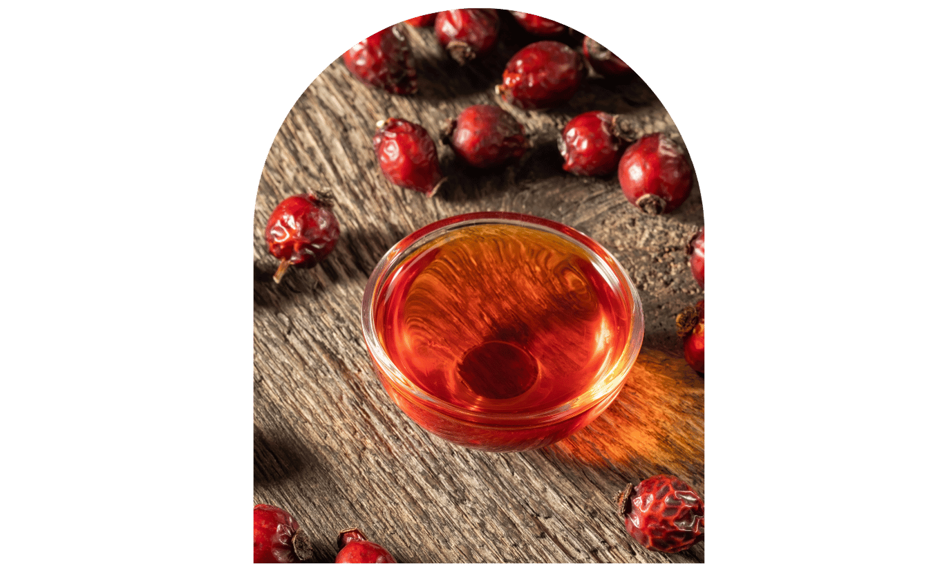 The Power of Rosehip Oil: 5 Amazing Benefits for Healthy Skin – Gentle ...