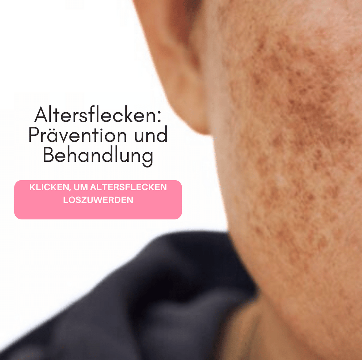 Altersflecken: Prävention und Behandlung